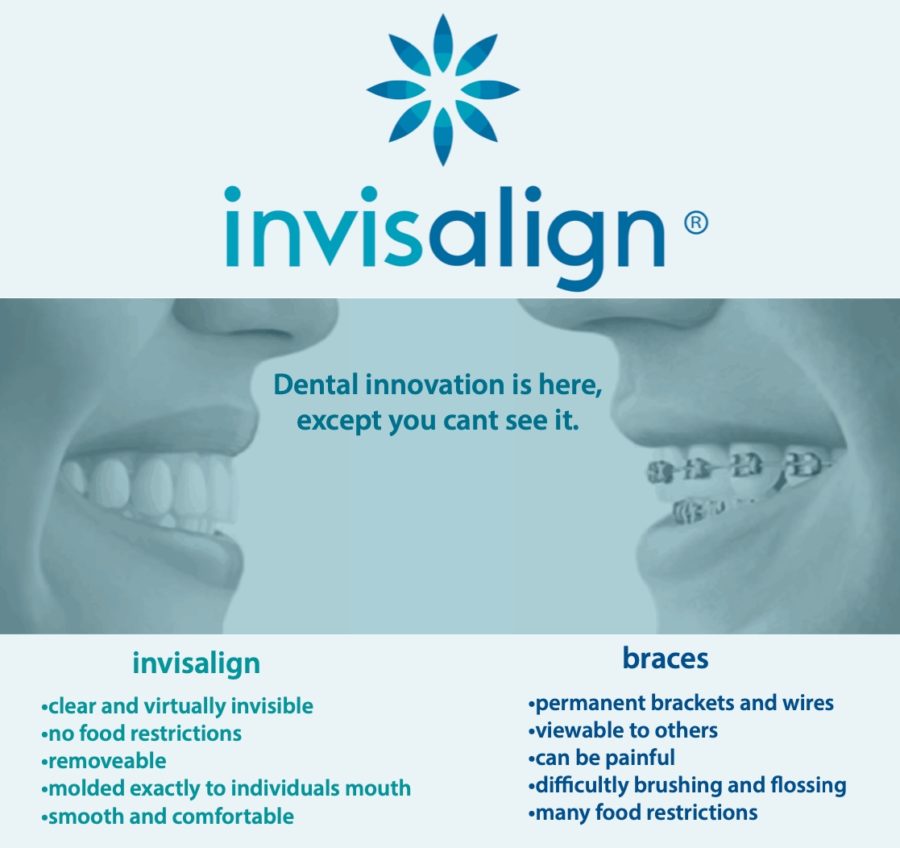 Invisalign in Indianapolis IN | Clear Aligners in Carmel
